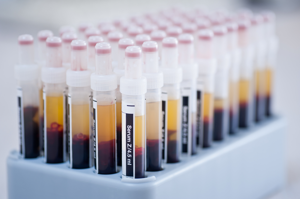 SS serum Tubes Intrinsic LifeSciences